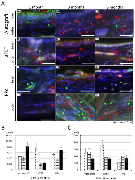 Regeneration Process of an Autologous Tissue-Engineered Trachea (aTET ...