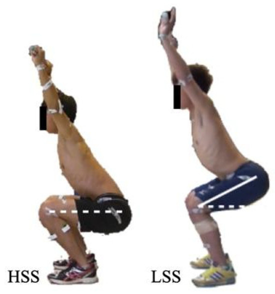 Does Deep Squat Quality Affect the Propulsion of Baseball Throwing?