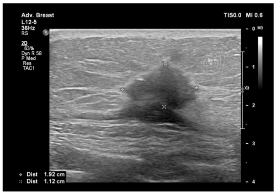Bioengineering | Free Full-Text | Evaluating the Role of Breast ...