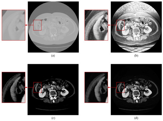 Enhancing Diagnostic Images to Improve the Performance of the Segment ...
