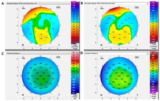 Applications of Imaging Technologies in Fuchs Endothelial Corneal ...