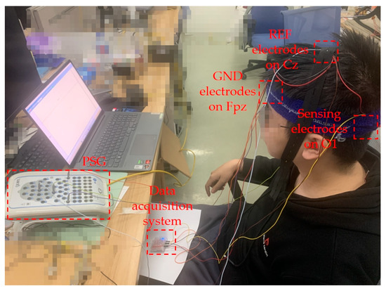 Active Claw-Shaped Dry Electrodes for EEG Measurement in Hair Areas