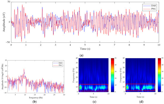 Active Claw-Shaped Dry Electrodes for EEG Measurement in Hair Areas