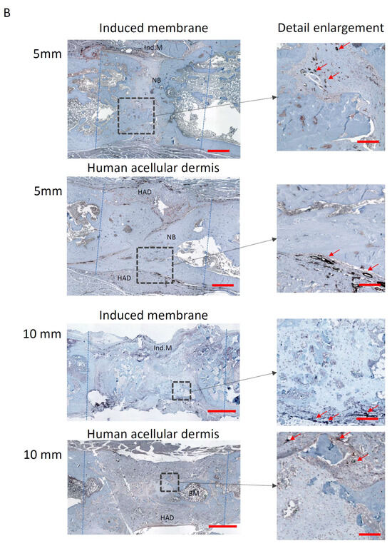 The Impact of Defect Size on Bone Healing in Critical-Size Bone Defects ...
