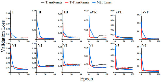 Wearable 12-Lead ECG Acquisition Using a Novel Deep Learning Approach ...