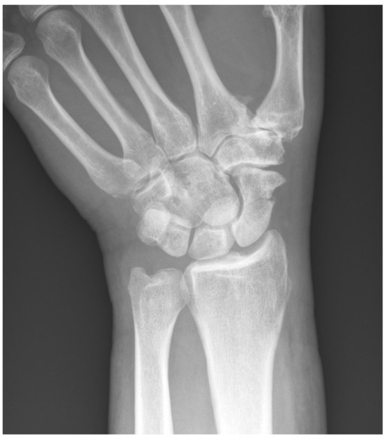 The Role of Artificial Intelligence in the Identification and ...