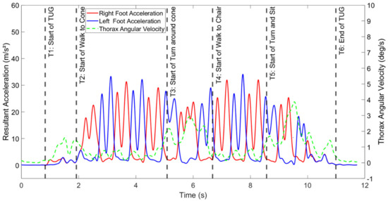 Post-Stroke Functional Changes: In-Depth Analysis of Clinical Tests and ...