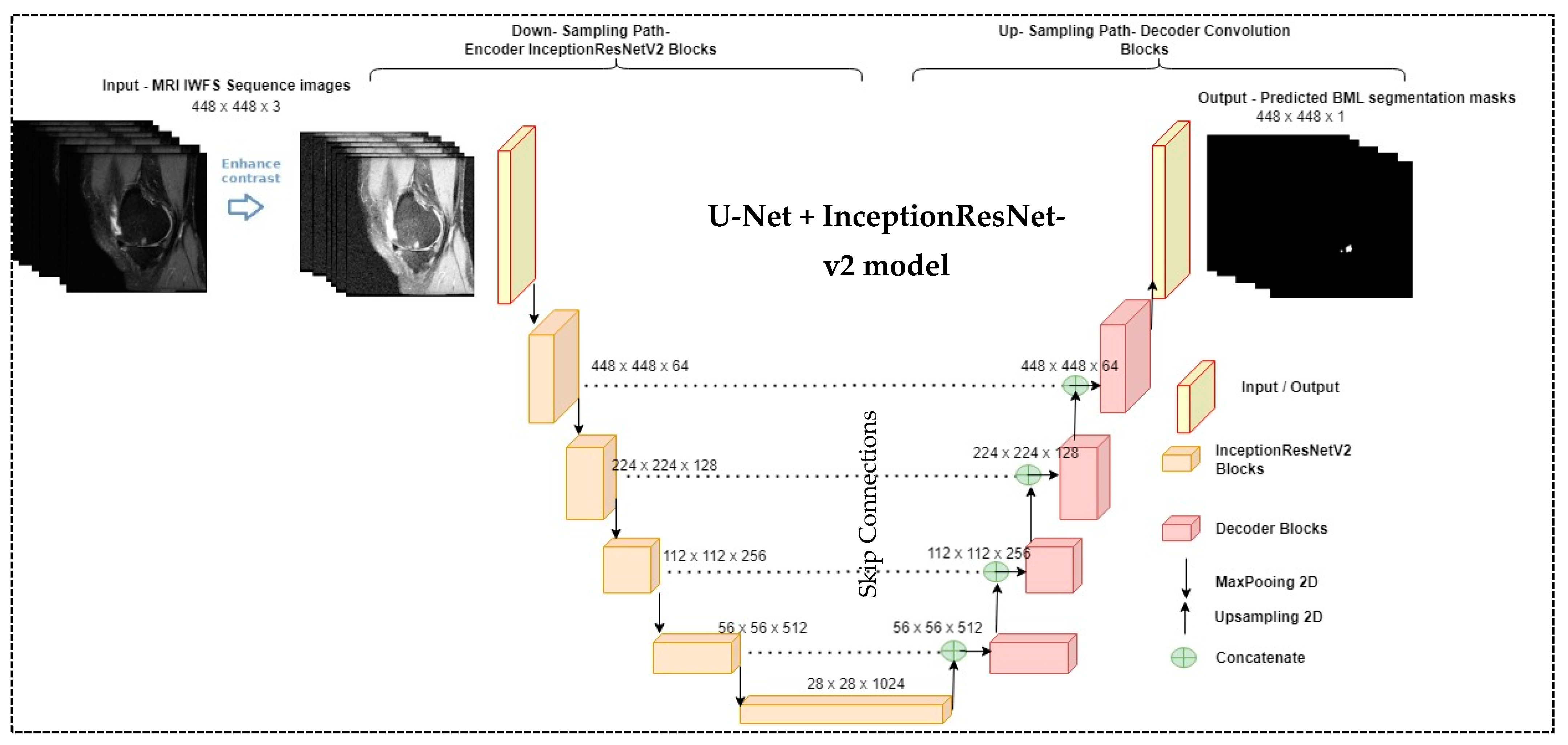 Automatic Segmentation of Bone Marrow Lesions on MRI Using a Deep ...