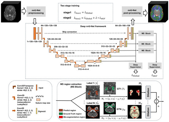 Bioengineering | Free Full-Text | A Novel Mis-Seg-Focus Loss Function Based on a Two-Stage nnU ...