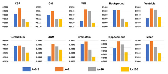 A Novel Mis-Seg-Focus Loss Function Based on a Two-Stage nnU-Net ...