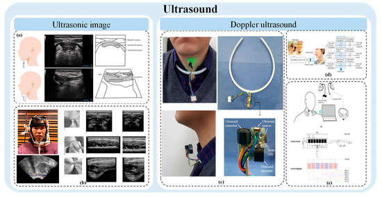 Advancements and Challenges in Non-Invasive Sensor Technologies for ...