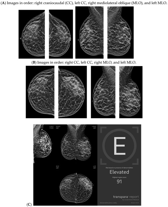 New Frontiers in Breast Cancer Imaging: The Rise of AI