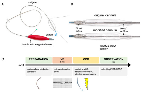 The Self-Expandable Impella CP (ECP) as a Mechanical Resuscitation Device
