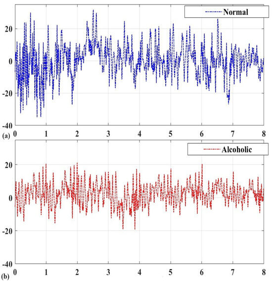Bioengineering | Free Full-Text | Fast Fractional Fourier Transform-Aided Novel Graphical ...