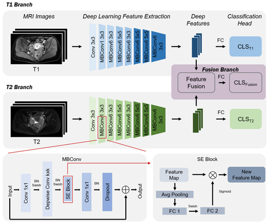 Preoperative Molecular Subtype Classification Prediction of Ovarian ...