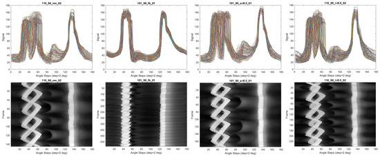 Gait Impairment Analysis Using Silhouette Sinogram Signals and Assisted ...