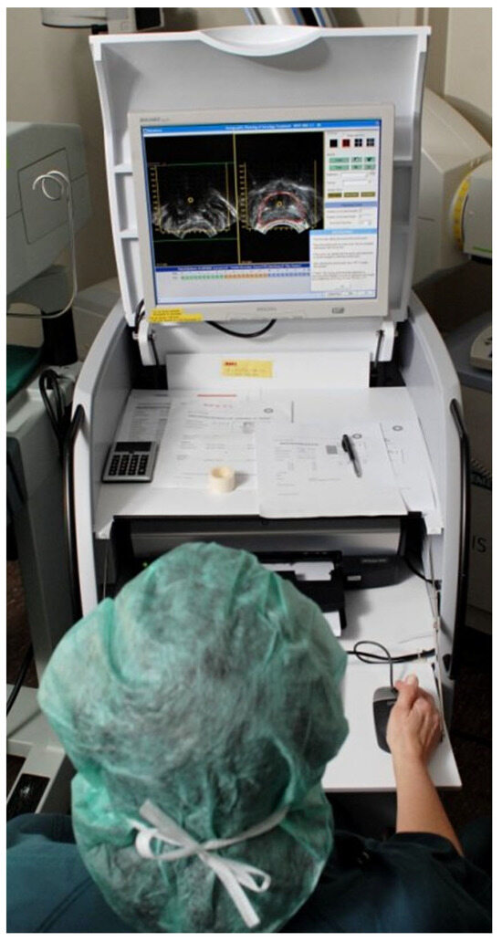Integration of Ultrasound in Image-Guided Adaptive Brachytherapy in ...