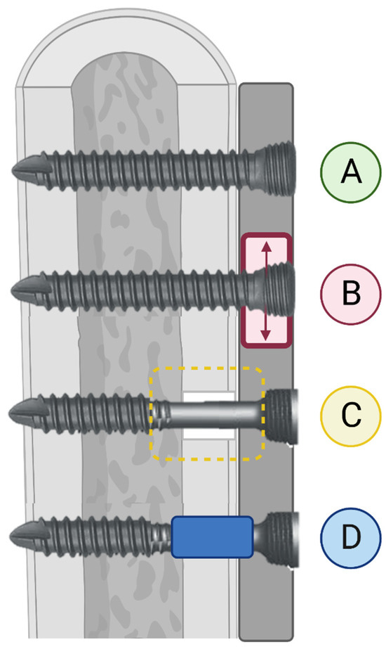 Delayed Union and Nonunion: Current Concepts, Prevention, and ...