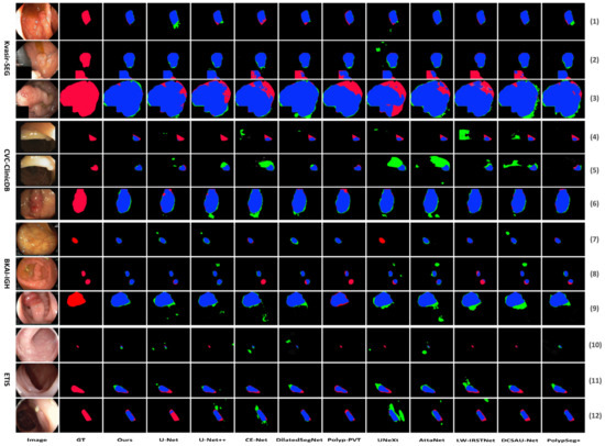 Bioengineering | Free Full-Text | LightCF-Net: A Lightweight Long-Range Context Fusion Network ...