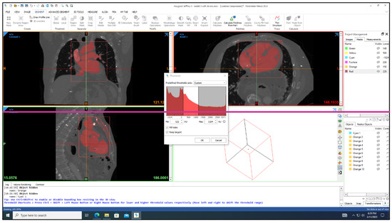 Advancements in Finite Element Modeling for Cardiac Device Leads and 3D ...