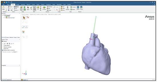 Advancements in Finite Element Modeling for Cardiac Device Leads and 3D ...
