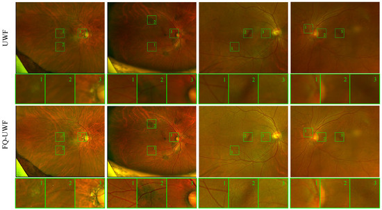 Bioengineering | Free Full-Text | FQ-UWF: Unpaired Generative Image ...