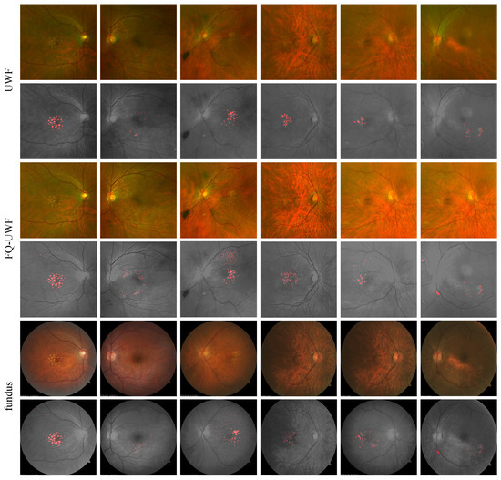 Bioengineering | Free Full-Text | FQ-UWF: Unpaired Generative Image ...