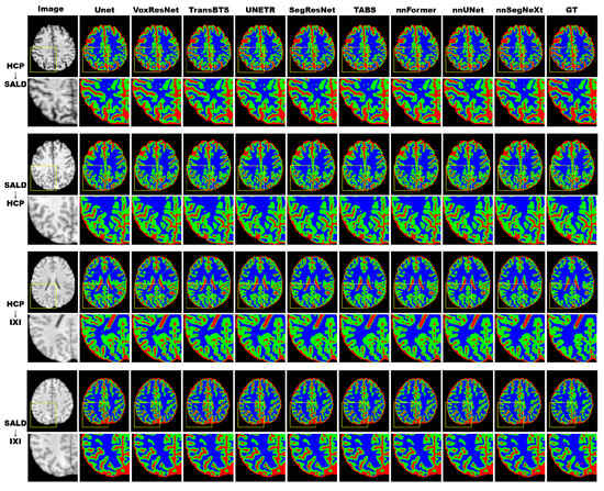 nnSegNeXt: A 3D Convolutional Network for Brain Tissue Segmentation ...