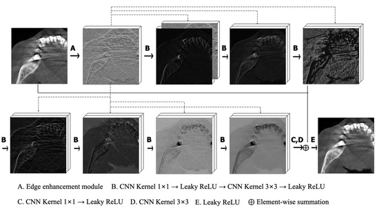 Preclinical and Preliminary Evaluation of Perceived Image Quality of AI-Processed Low-Dose CBCT ...