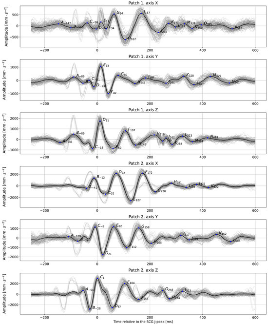 Automated Heart Rate Detection in Seismocardiograms Using Electrocardiogram-Based Algorithms—A ...