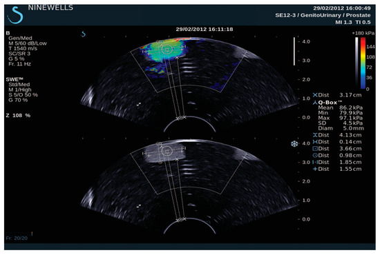 Tissue-Mimicking Material Fabrication and Properties for ...