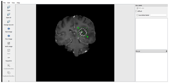 Enhancing Automated Brain Tumor Detection Accuracy Using Artificial Intelligence Approaches for ...