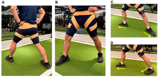 The Influence of Dynamic Taping on Landing Biomechanics after Fatigue ...