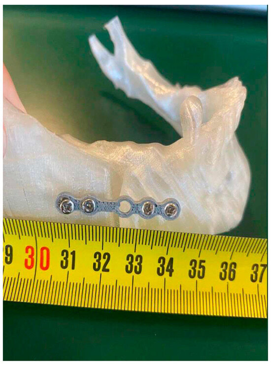 Bioengineering | Free Full-Text | A New Method to Design and ...