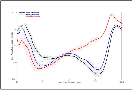 Influence of Internal and External Foot Rotation on Peak Knee Adduction ...