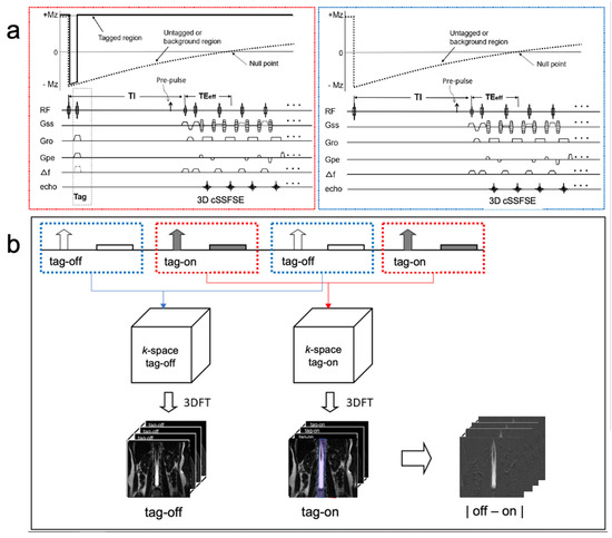 Visualization of Cerebrospinal Fluid Outflow and Egress along the Nerve ...