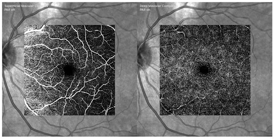 Bioengineering | Free Full-Text | A Comprehensive Review of AI ...