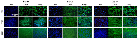 Fabrication and Evaluation of PCL/PLGA/β-TCP Spiral-Structured ...