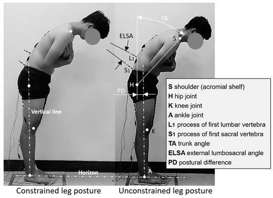 Bioengineering | Free Full-Text | Differential Back Muscle Flexion ...