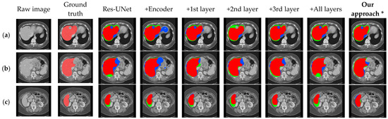 Dual Attention-Based 3D U-Net Liver Segmentation Algorithm on CT Images