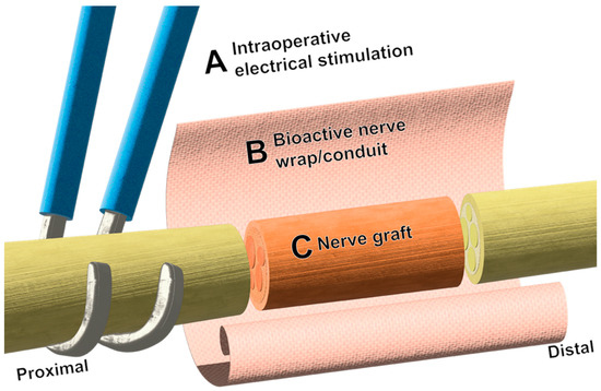 Bioengineering | Free Full-Text | Biohacking Nerve Repair: Novel ...