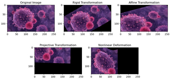 A Review of Medical Image Registration for Different Modalities