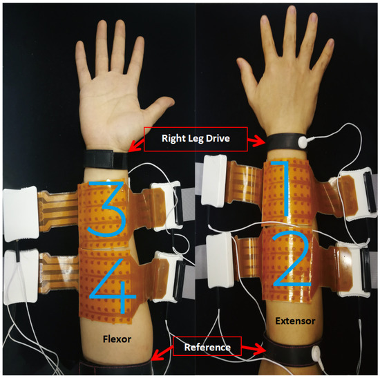 Effects of Exercise on the Inter-Session Accuracy of sEMG-Based Hand Gesture Recognition