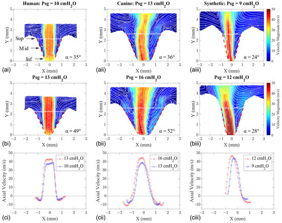 Comparison of Aerodynamic and Elastic Properties in Tissue and ...