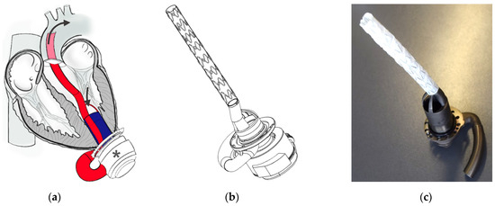 In Vivo Testing of a Second-Generation Prototype Accessory for Single ...