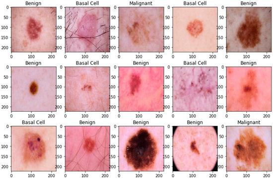 High-Precision Skin Disease Diagnosis through Deep Learning on ...