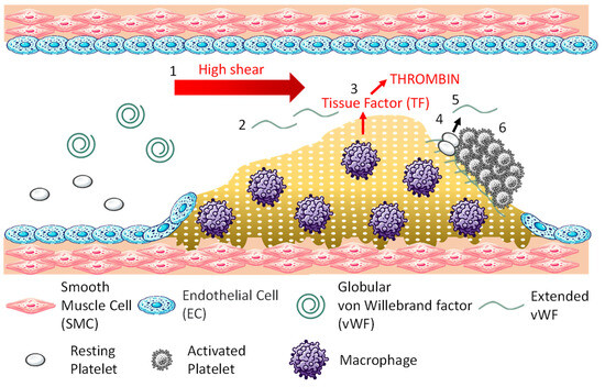 Predictive Methods for Thrombus Formation in the Treatment of Aortic ...