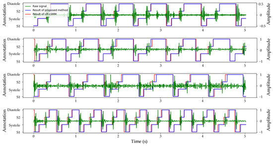 Segmentation of Heart Sound Signal Based on Multi-Scale Feature Fusion and Multi-Classification ...