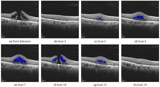 Segment Anything in Optical Coherence Tomography: SAM 2 for Volumetric ...