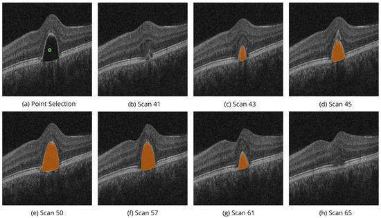 Segment Anything in Optical Coherence Tomography: SAM 2 for Volumetric ...
